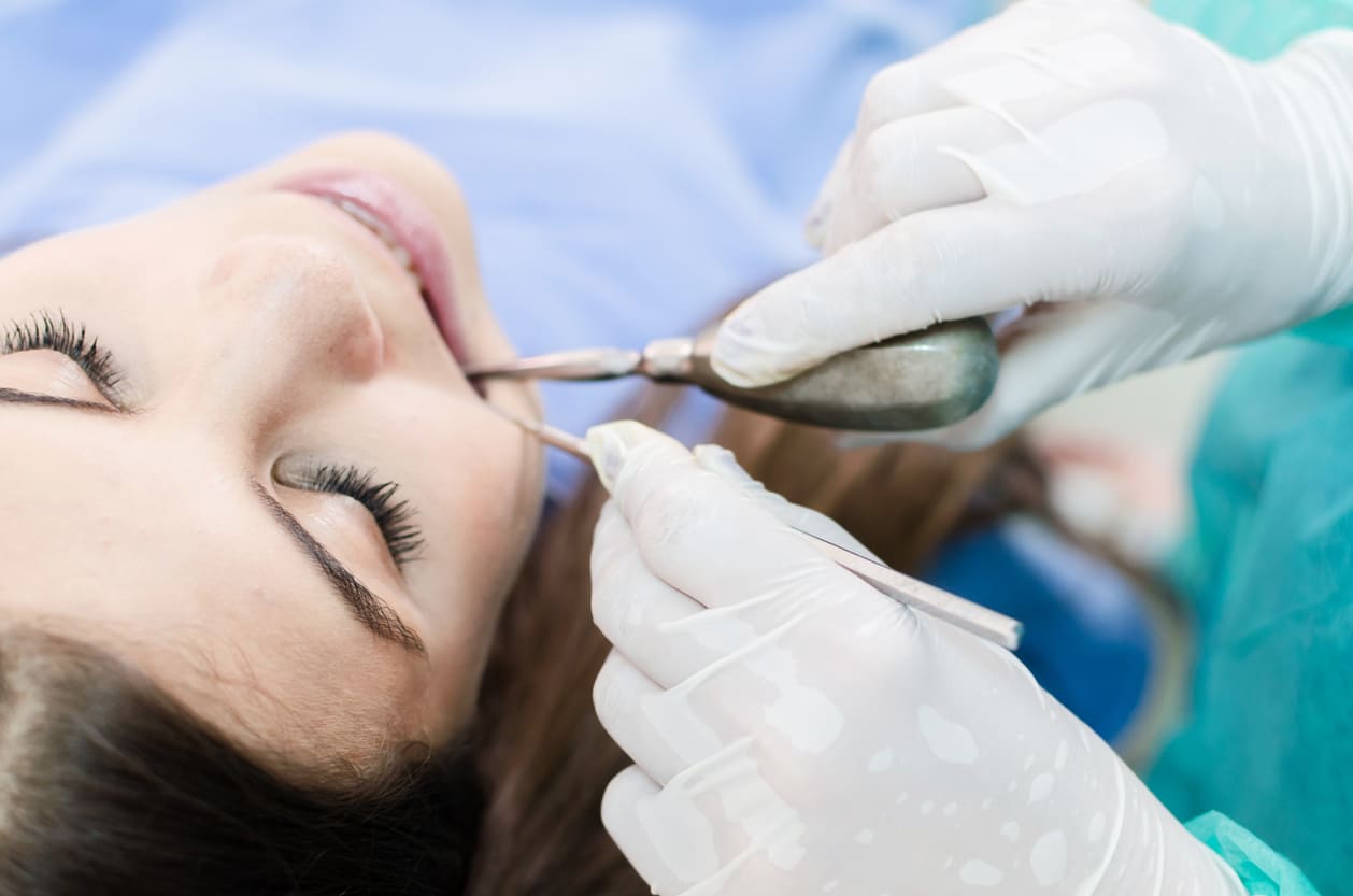 Persiapkan Hal ini Sebelum Menjalani Perawatan Saluran Akar Gigi ...