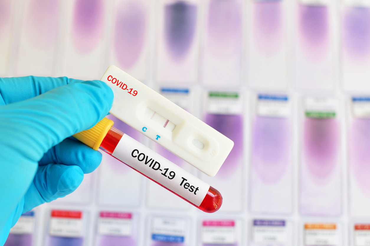 Rapid Test Virus Corona Covid-19, Begini Prosedurnya | HonestDocs