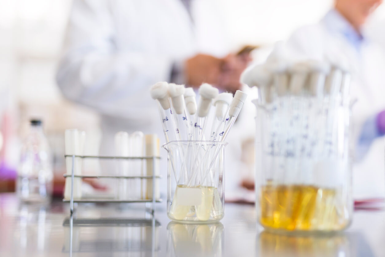 3 Proses Pembentukan Urine dalam Tubuh | HonestDocs