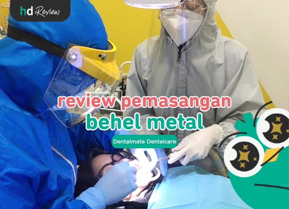 Review Pemasangan Behel Metal | HDmall