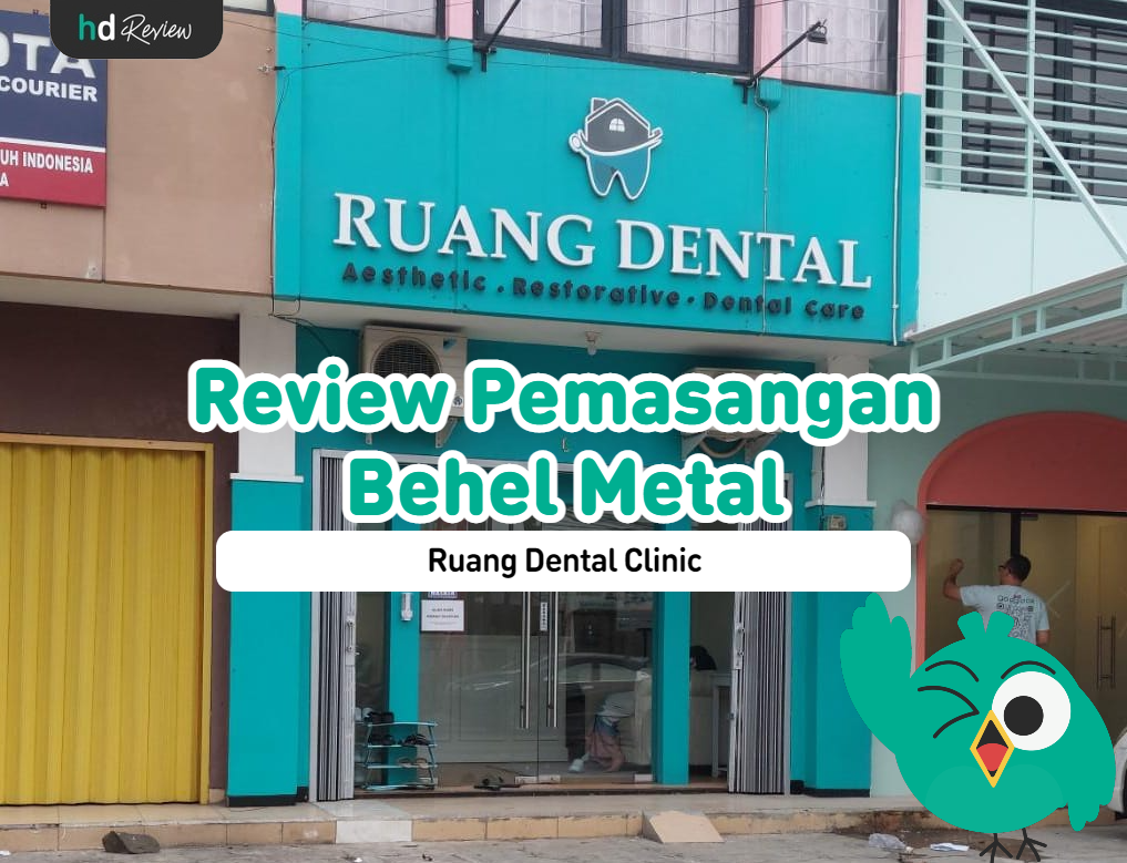 Review Pemasangan Behel Metal | HDmall