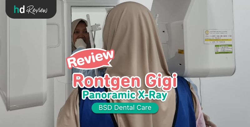 Review Rontgen Gigi Panoramic di BSD Dental Care | HDmall